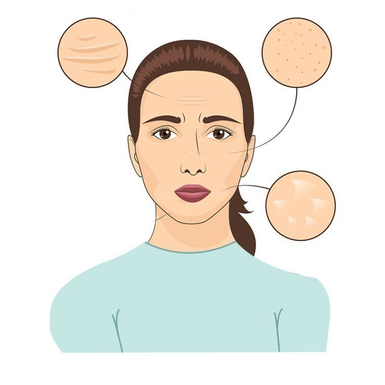 Diamond Facials: Does It Actually Work Improving Skin Quality?